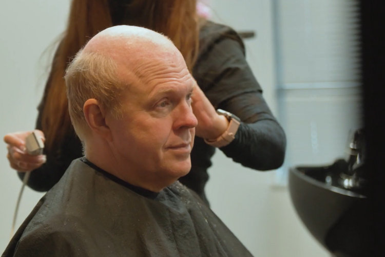 Dallas Hair Replacement Studio for Men Shares Advice - Are You a Good ...