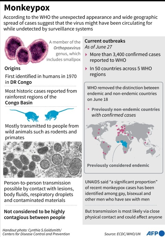 UK monkeypox symptoms different to prior outbreaks: study